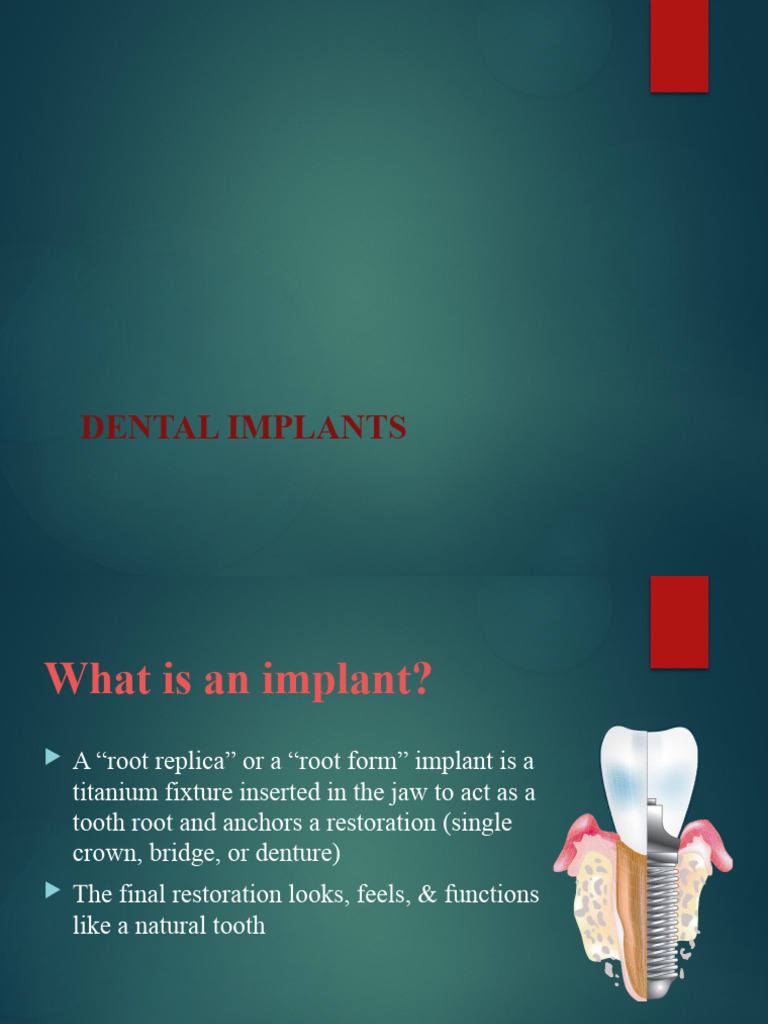 Dental Implants | PDF | Dental Implant | Dentistry Branches