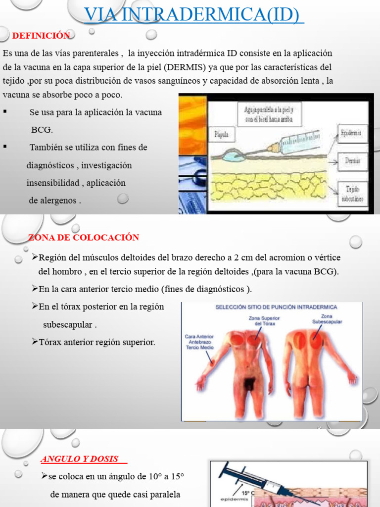 Via Intradermica | Descargar gratis PDF | Inyección (medicina ...