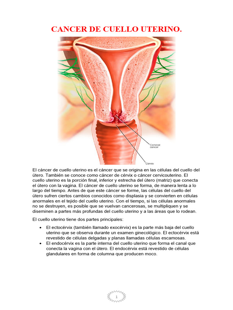 Cancer de Cuello Uterino | PDF | Cáncer de cuello uterino | Cáncer