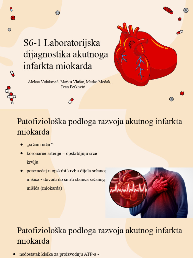 S6-1 Laboratorijska Dijagnostika Akutnoga Infarkta Miokarda | PDF