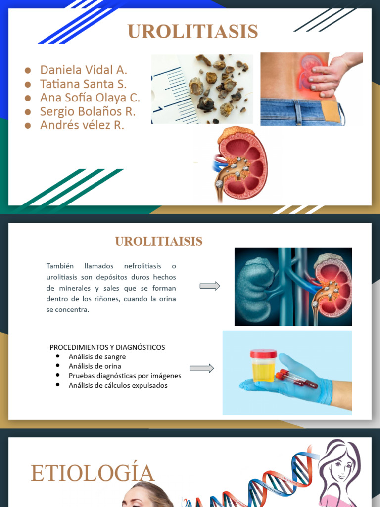 Guía Completa sobre Urolitiasis | PDF | Órgano (anatomía) | Medicina ...