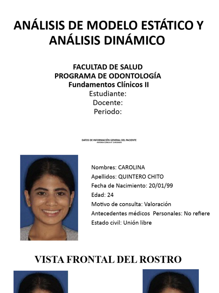 ANÁLISIS DE MODELO ESTÁTICO Y ANÁLISIS DINÁMICO | PDF