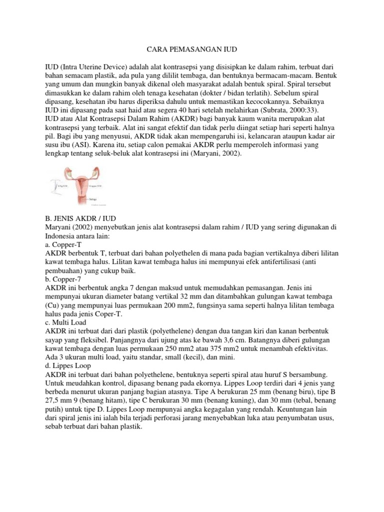 Cara Pemasangan Iud | PDF