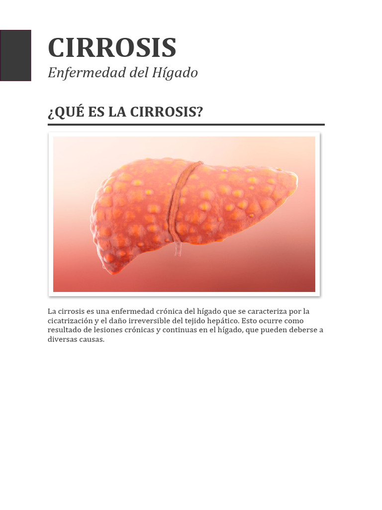 Enfermedad de Cirrosis | PDF | Cirrosis | Hepatitis