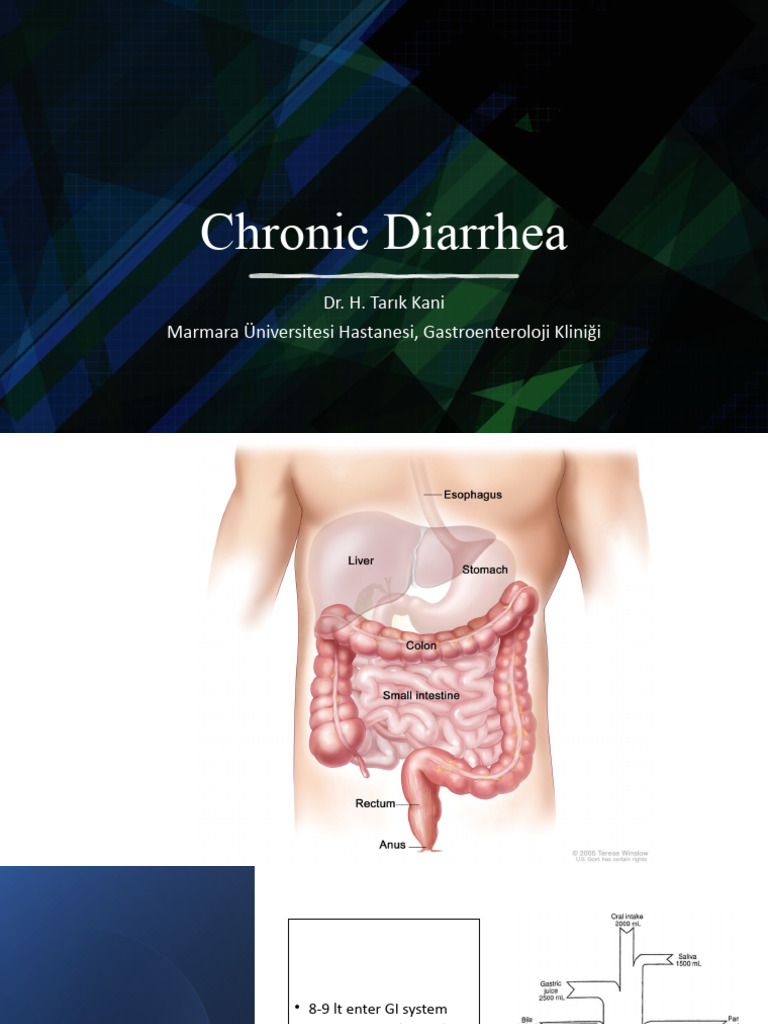 Chronic Diarrhea-HTK | PDF | Diarrhea | Irritable Bowel Syndrome