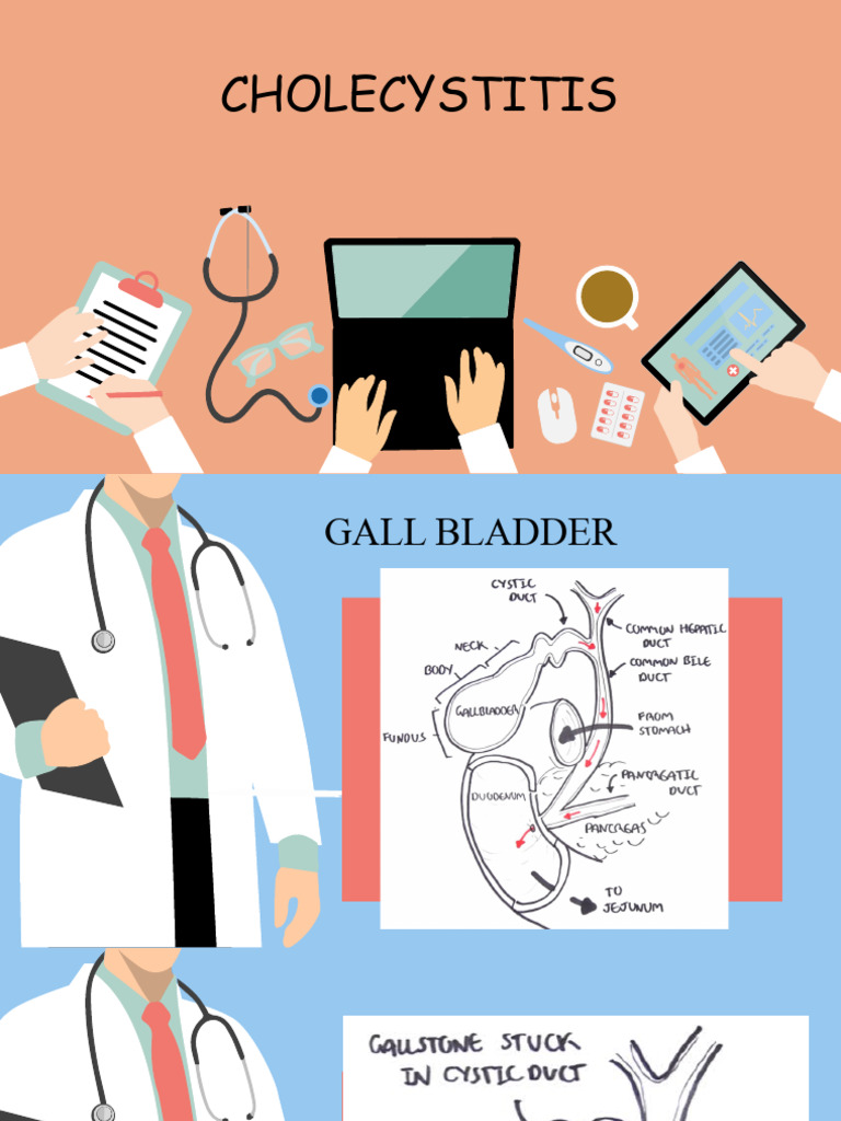 Cholecystitis | PDF | Gallbladder | Digestive Diseases