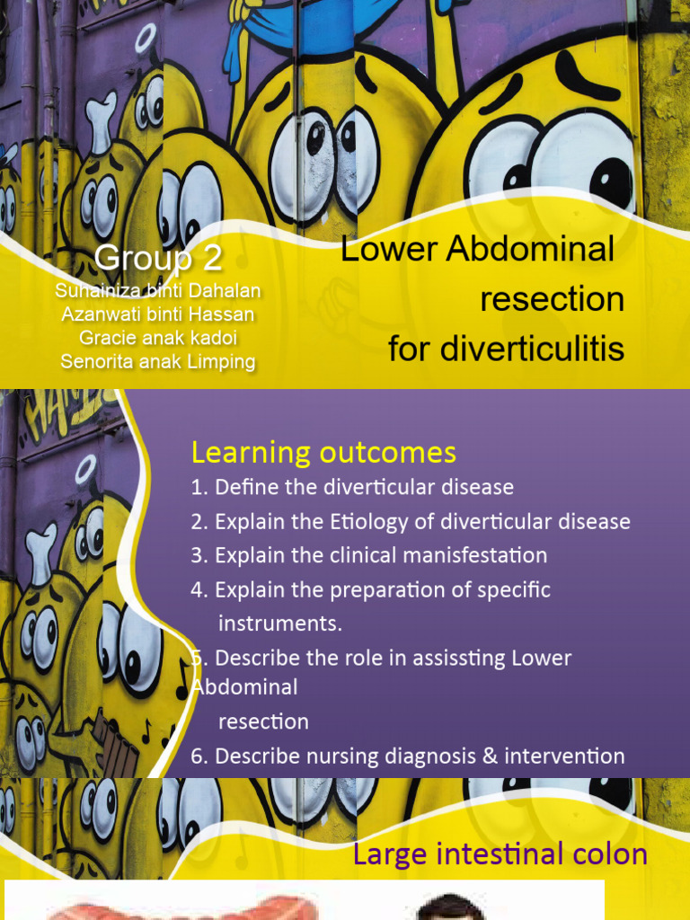 Diverticulitis Surgery Guide | PDF | Medicine | Digestive Diseases