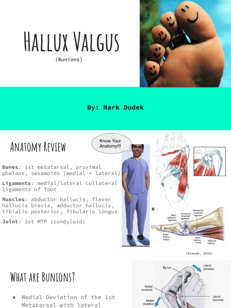 Hallux Valgus | PDF | Foot | Toe