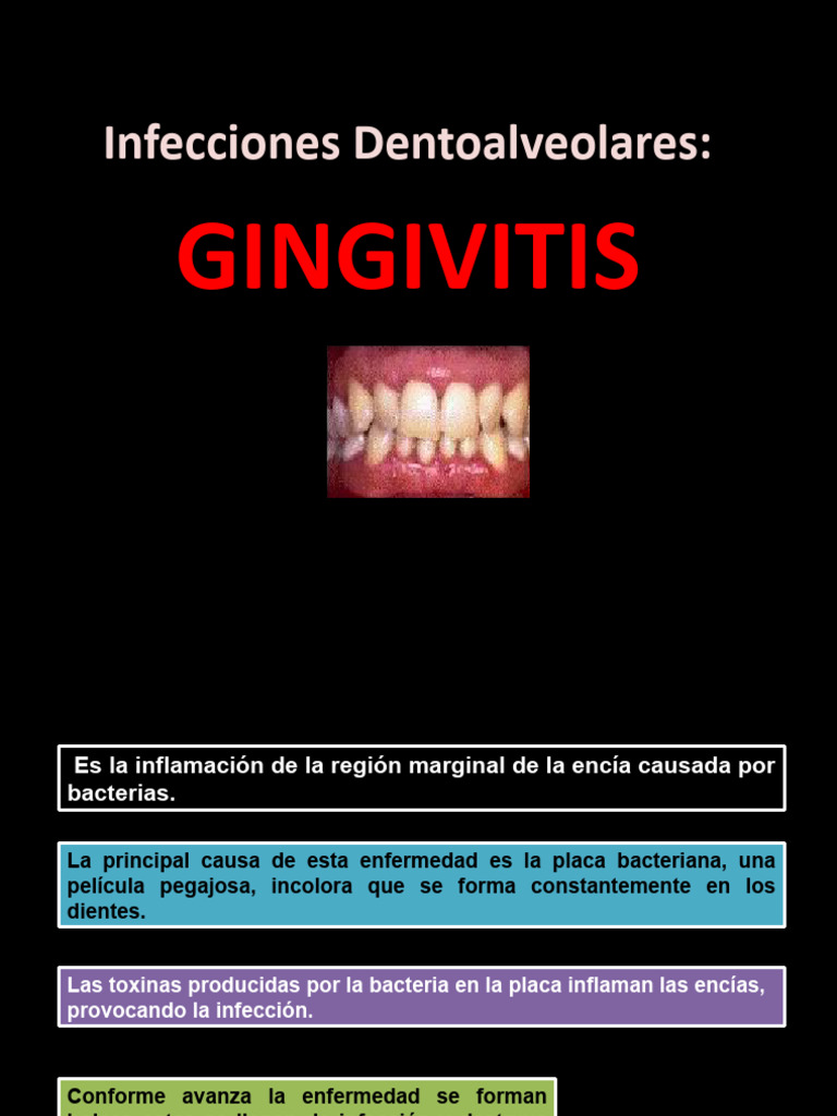GINGIVITIS | PDF | Causas de la muerte | Microbiología