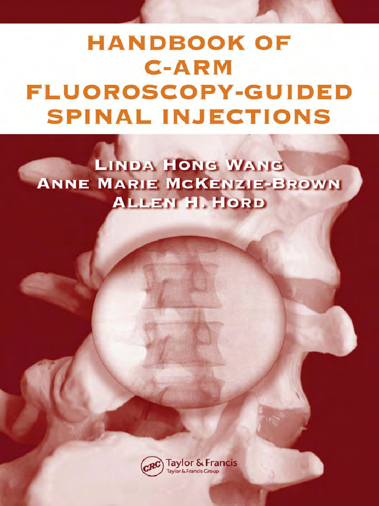Fluoroscopy Spinal Inyection | PDF | Vertebral Column | Medicine