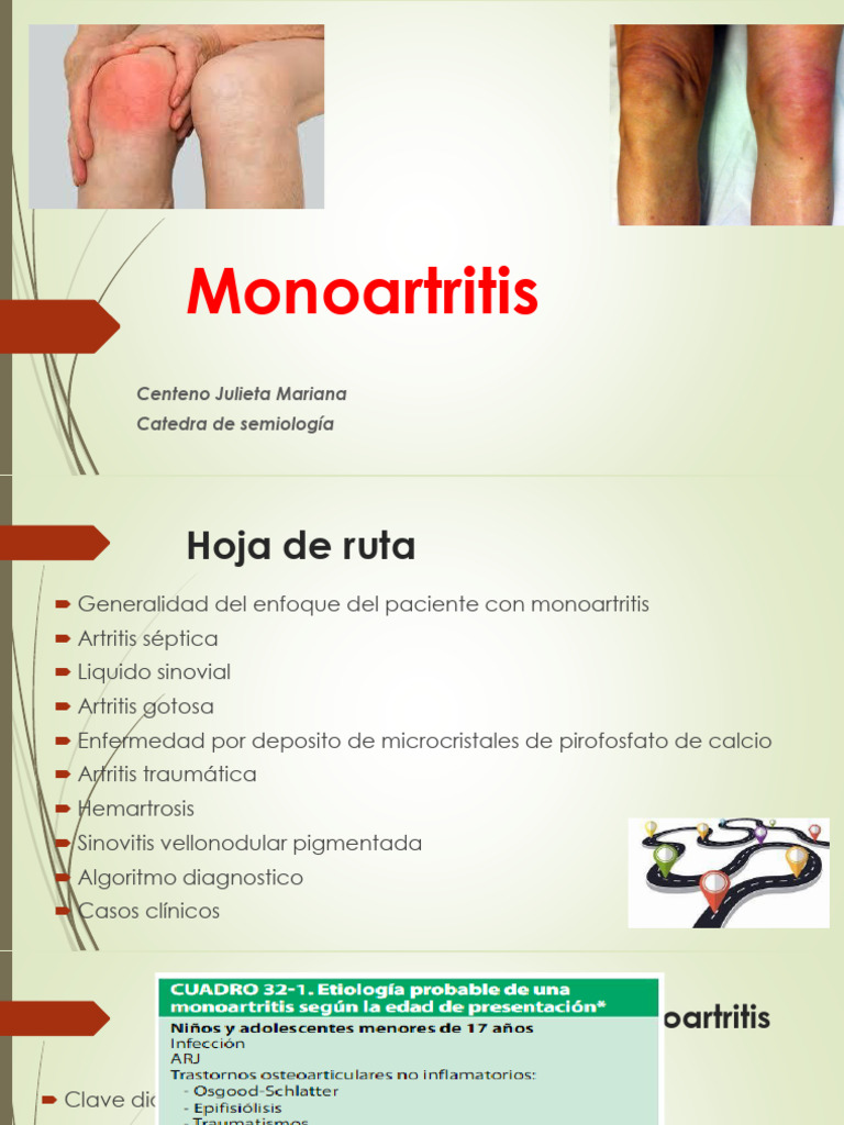 Monoartritis | PDF | Gota | Rodilla
