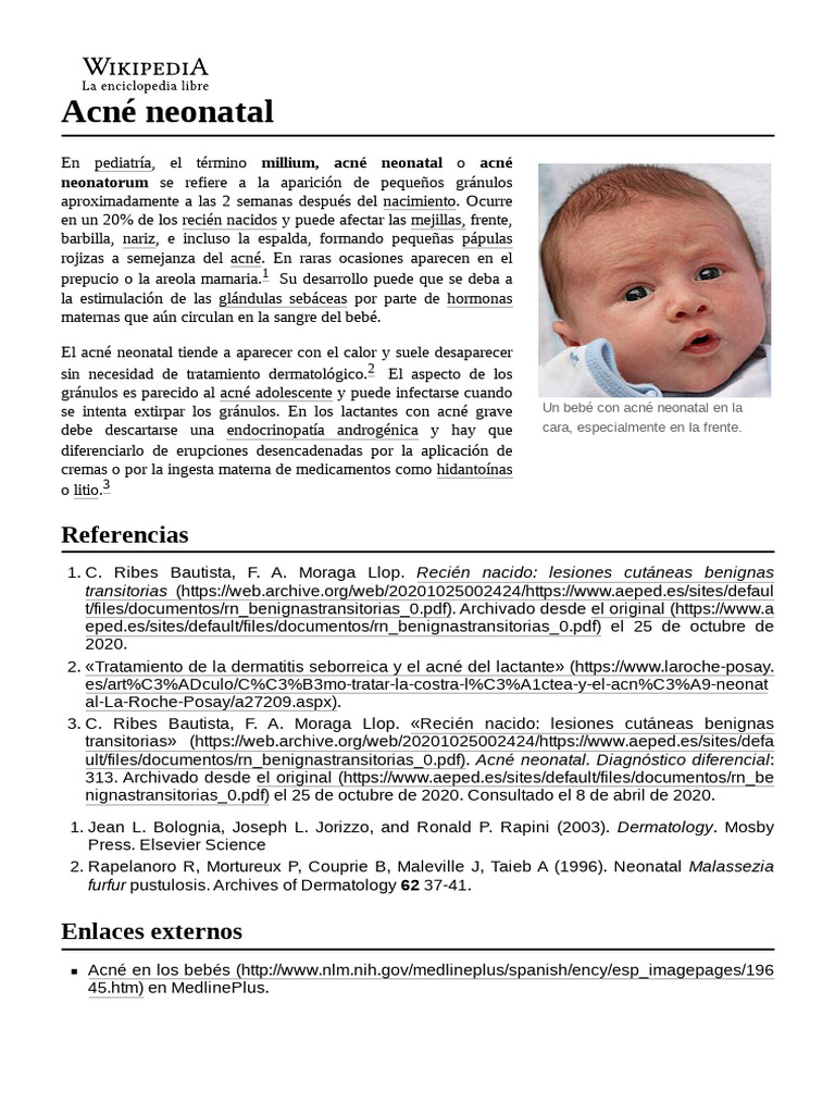 Acné Neonatal | PDF | Medicina | Medicina CLINICA