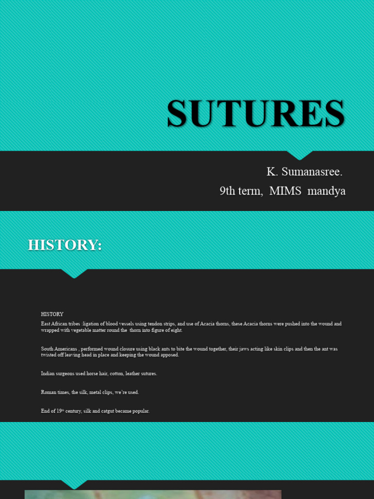 Suture Presentation | PDF | Surgical Suture | Surgery