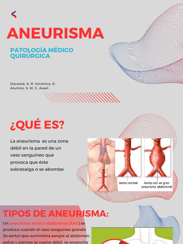 ANEURISMA | PDF