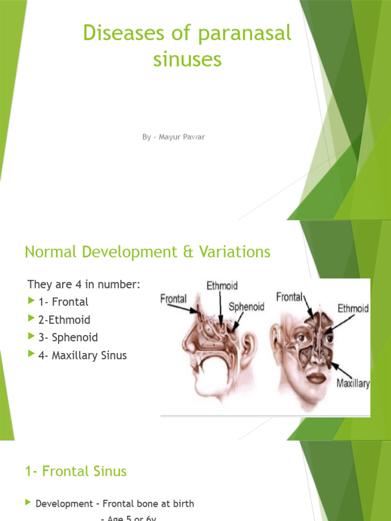 Paranasal Sinus Diseases Overview | PDF | Foreign Language Studies