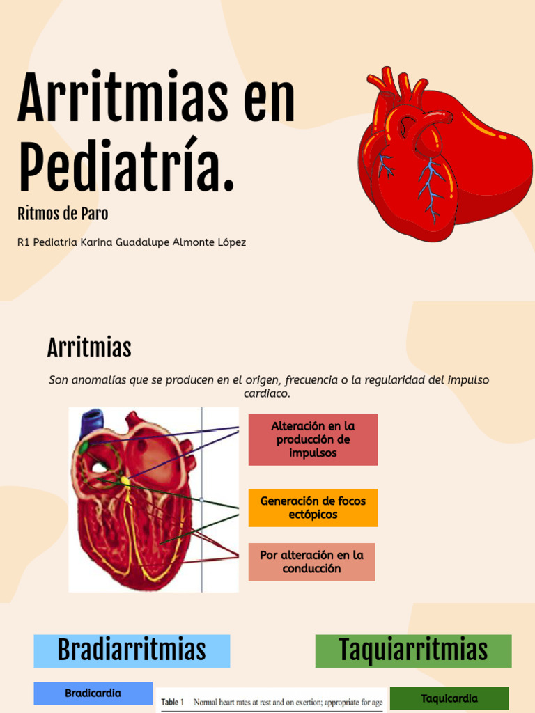 Arritmias en Pediatria. | PDF