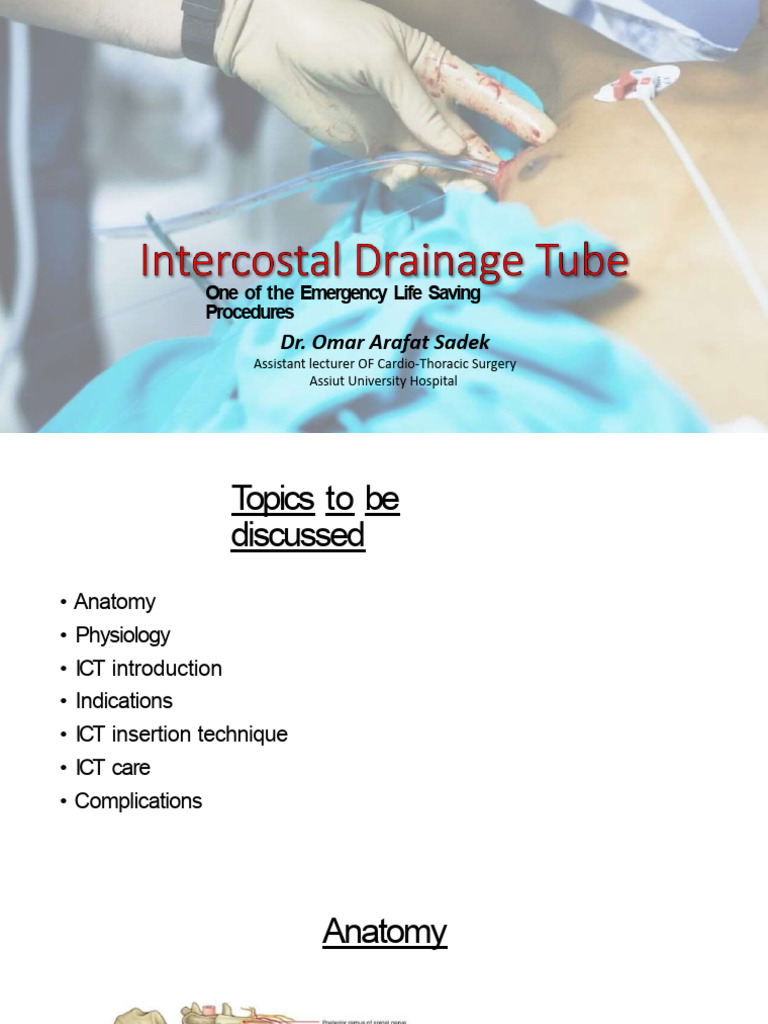 Intercostal Drainage Tube | PDF