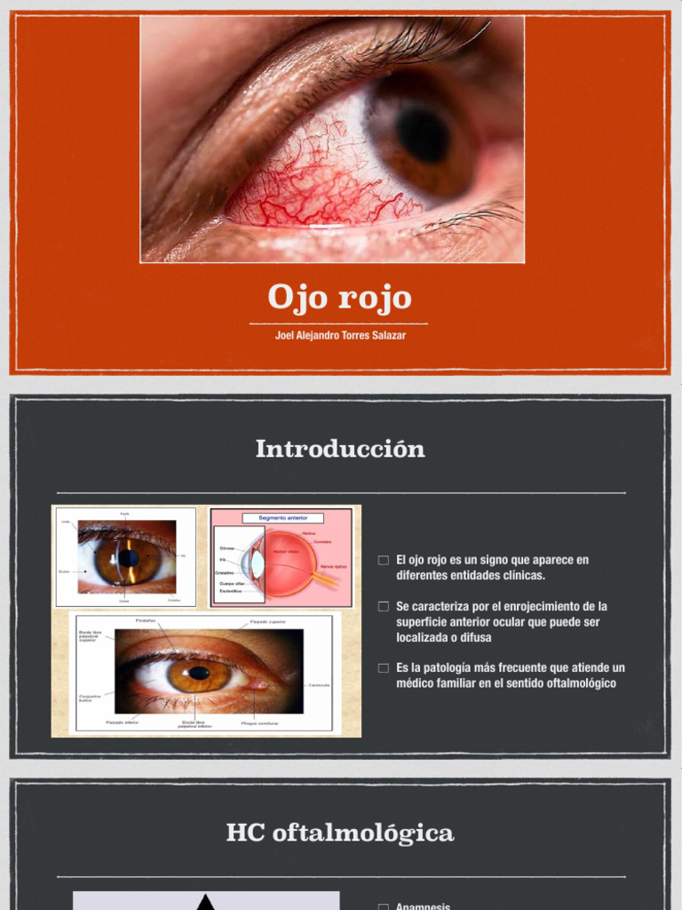 Ojo Rojo | PDF