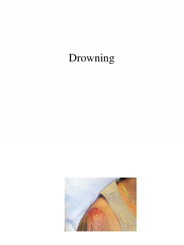 Sharp Force Trauma Overview | PDF