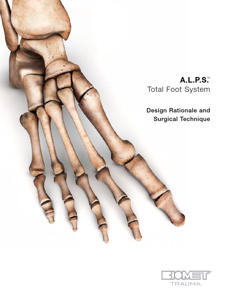 Alps Total Foot System Surgical Technique 1 | PDF | Drill | Screw