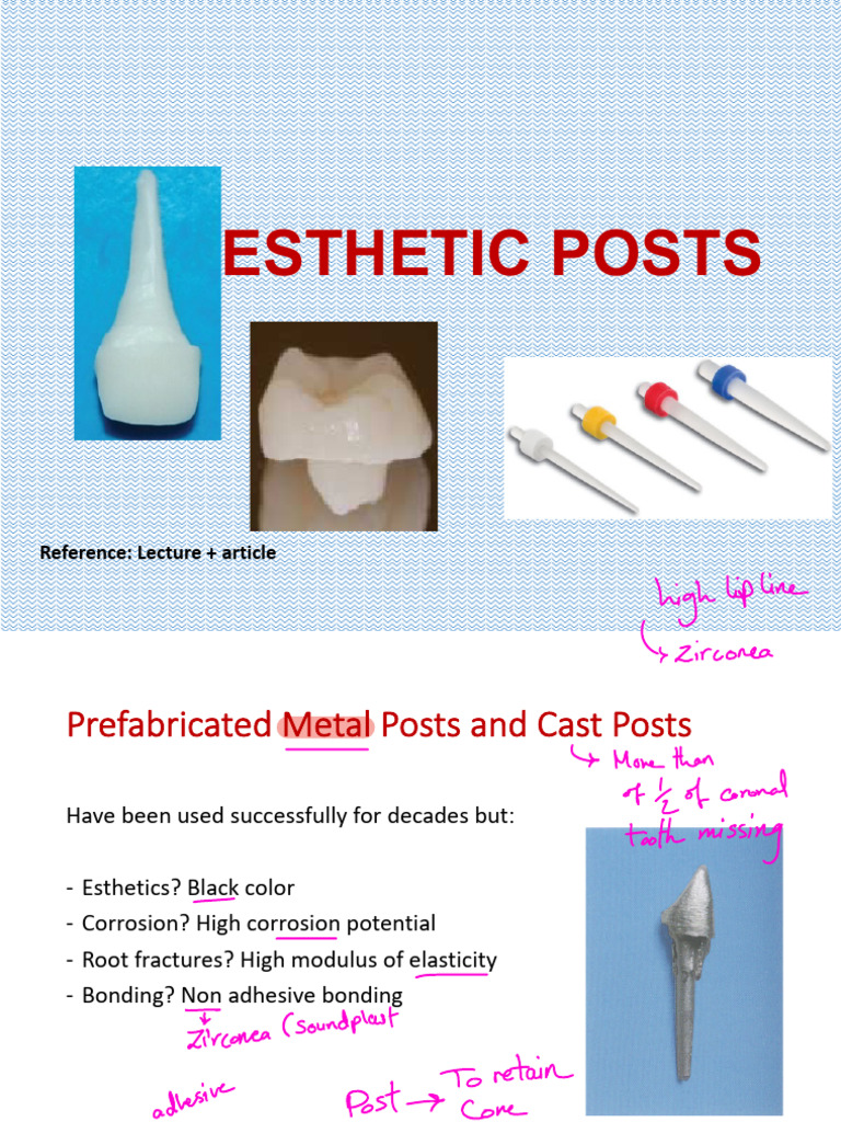 4 - Esthetic Post | Download Free PDF | Zirconium Dioxide | Physical ...