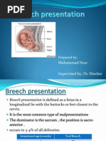 Administering Medications and or Feeding Dobhoff or A PEG Tube Rev 11 ...