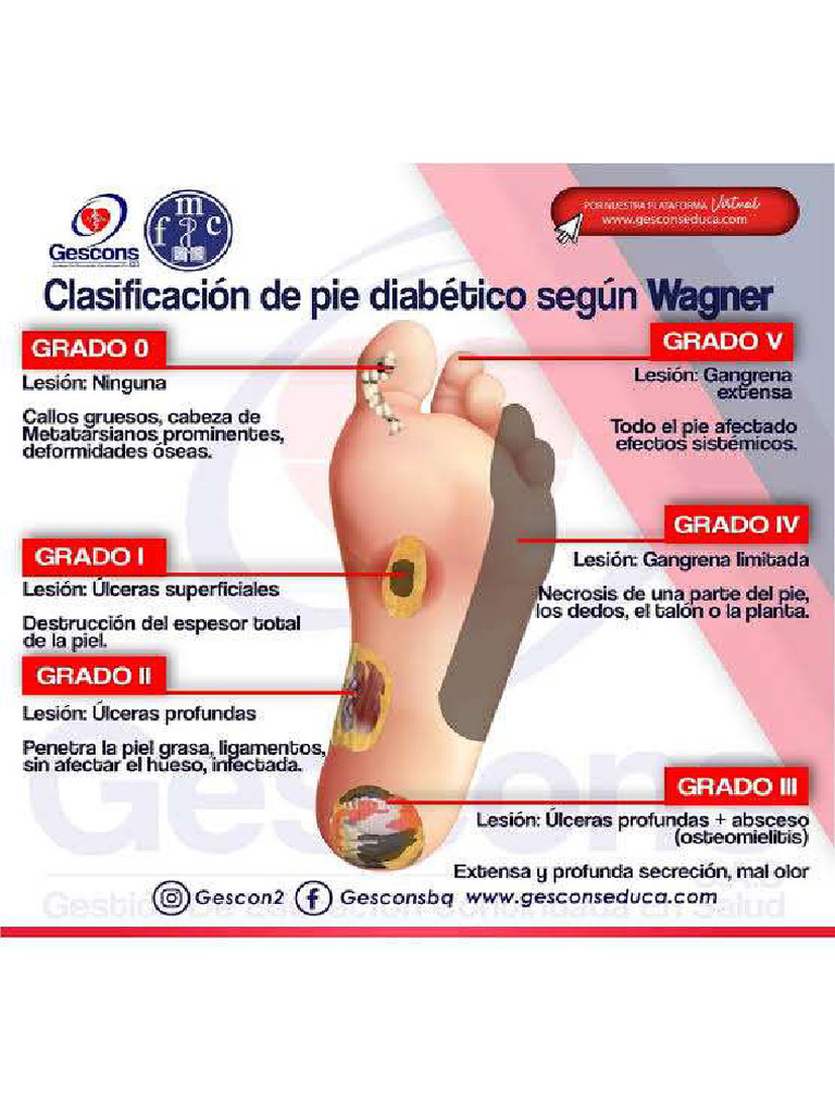 Clasificación wagner | PDF