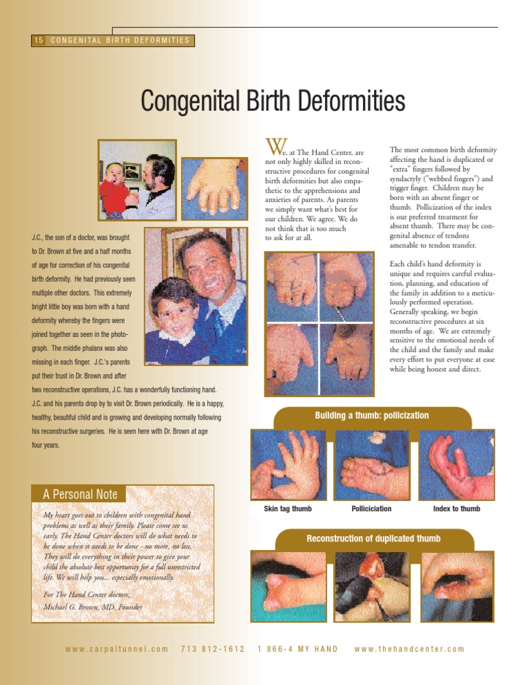 Congenital Birth Deformities | PDF | Finger | Hand