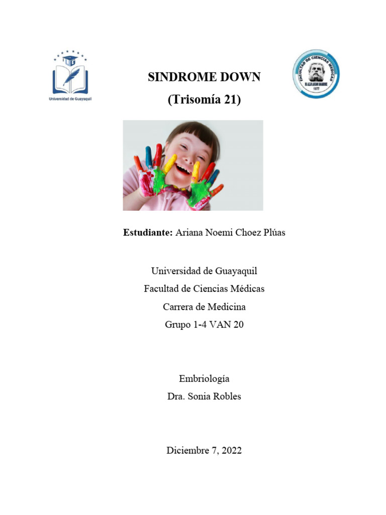 Síndrome Down | PDF | Síndrome de Down | Causas de la muerte Síndrome Down | PDF | Síndrome de Down | Causas de la muerte