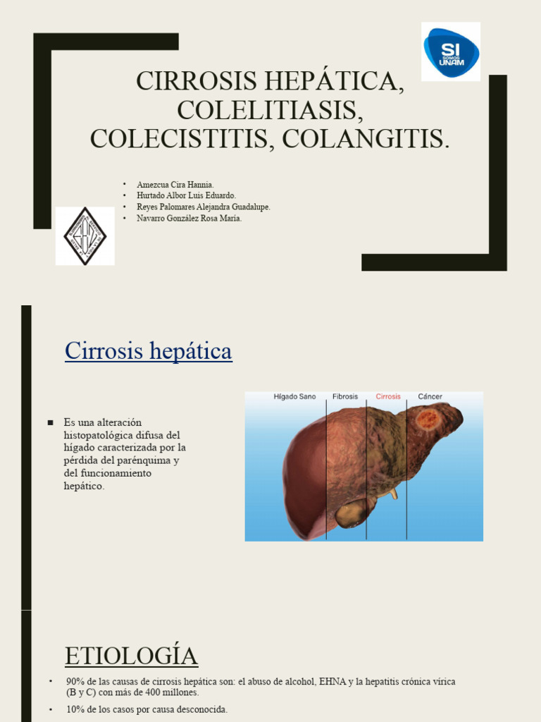 Copia de Cirrosis Hepática, Colelitiasis, Colecistitis, Colangitis-2 ...