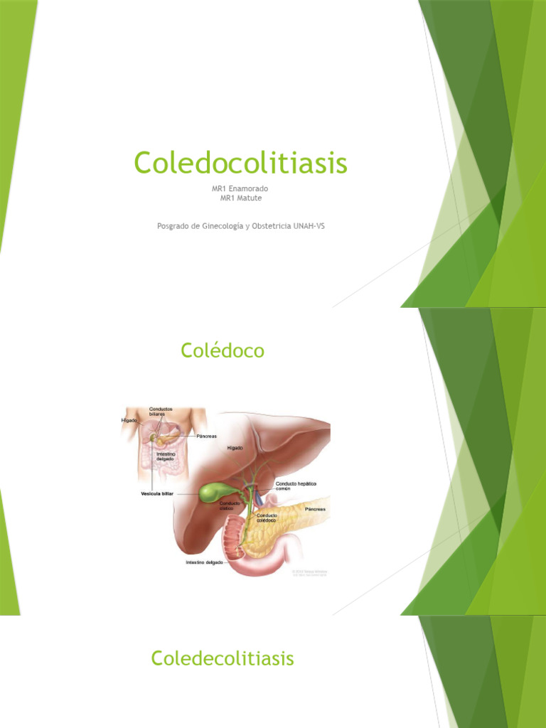 Coledocolitiasis | PDF