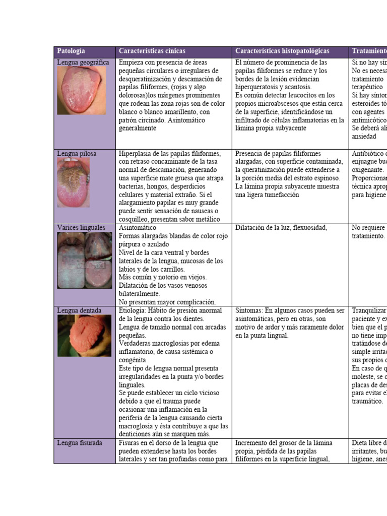 Microglosia y Macroglosia | PDF | Inflamación | Lengua