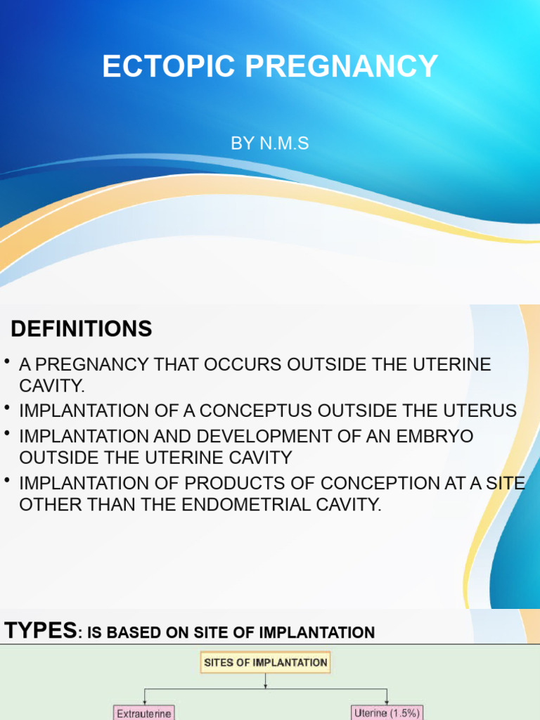 Ectopic Pregnancy Overview | PDF