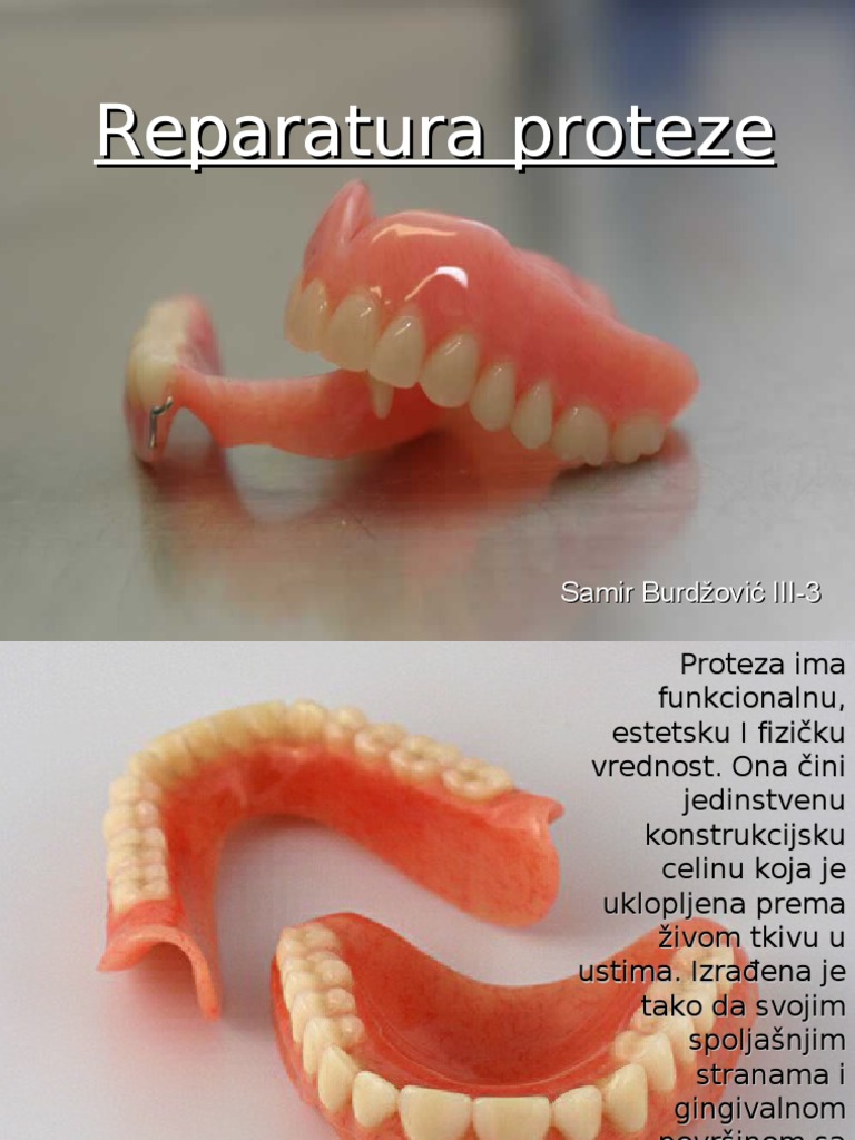 Reparatura proteze