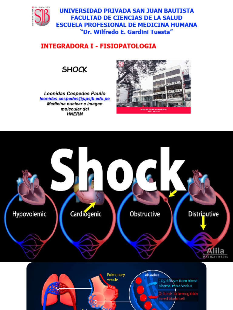 Shock | PDF
