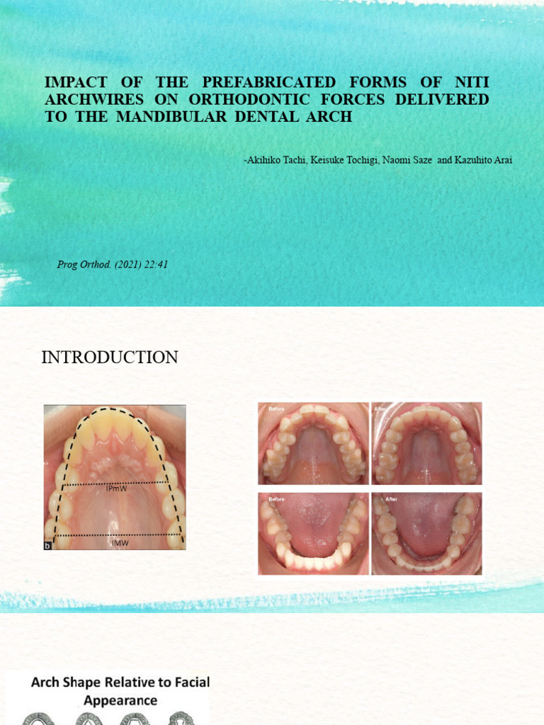 4.PREFORMED ARCH WIRES | PDF