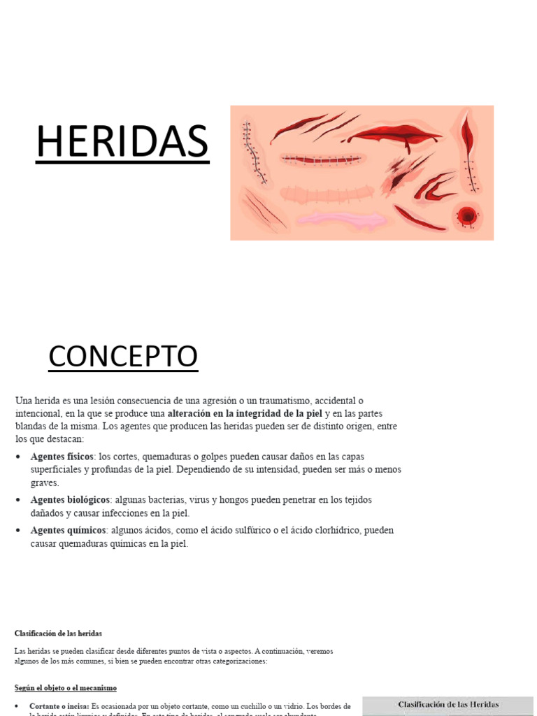 Las Heridas y Su Clasificacion | PDF | Herida | Cicatrización de la herida