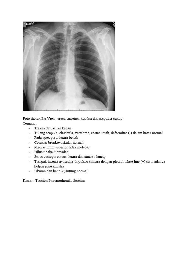 Foto Radiologi | PDF | Perjalanan | Seni