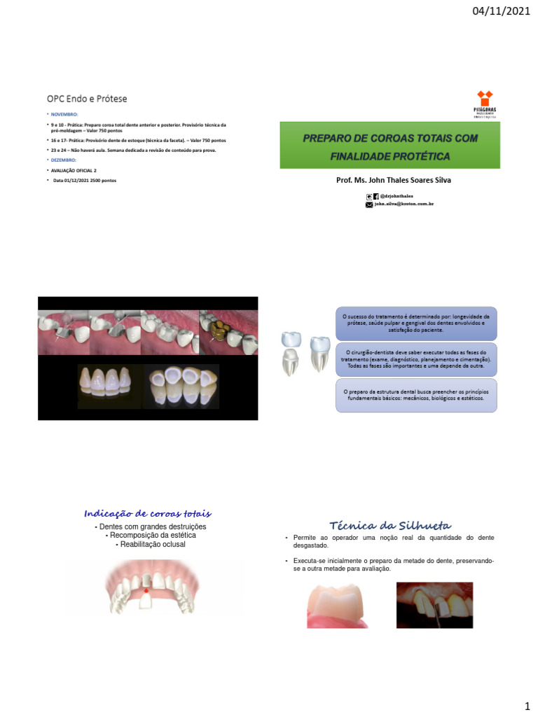 Aula 18 Preparo de Coroa Total Dente Anterior e Post - OPC | PDF ...