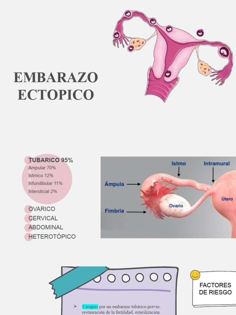 Embarazo Ectopico No Videos | PDF | El embarazo | Embarazo humano