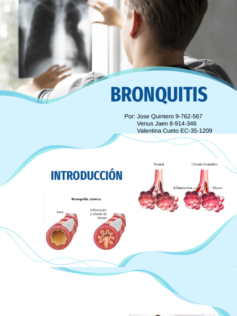 Bronquitis | PDF | Bronquitis | Tos