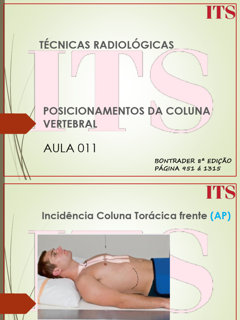 11 Posicionamentos Da Coluna Vertebral | PDF | Coluna vertebral | Escoliose