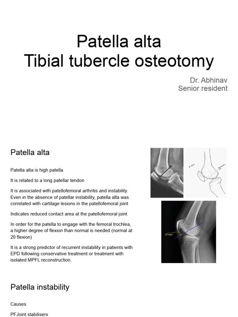 Patella Alta Tibial Tubercle Osteotomy | PDF | Knee | Musculoskeletal ...