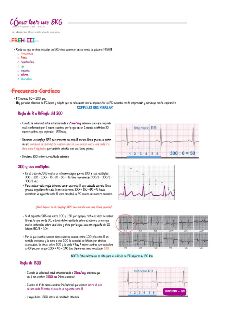 Como Leer Un EKG Paso A Paso | PDF