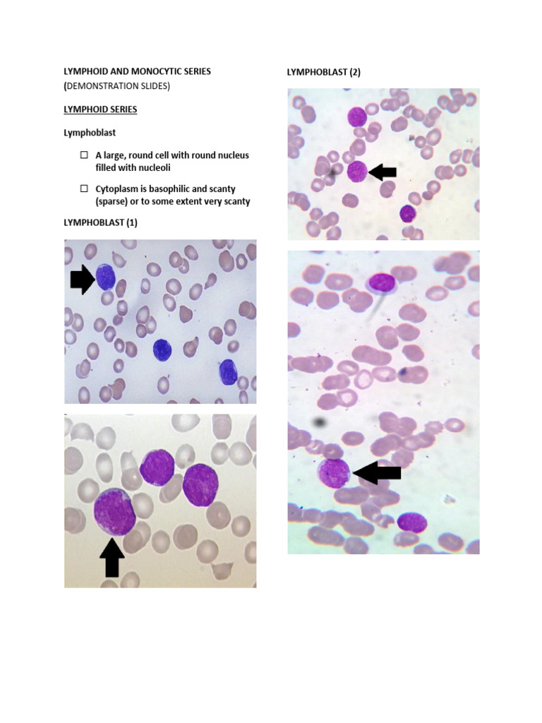 LYMPHOID AND MONOCYTIC SERIES Demonstration Slide | PDF | Lymphocyte ...