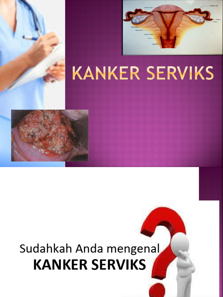 CA Serviks Presentation | PDF | Kesehatan Holistik | Sains & Matematika