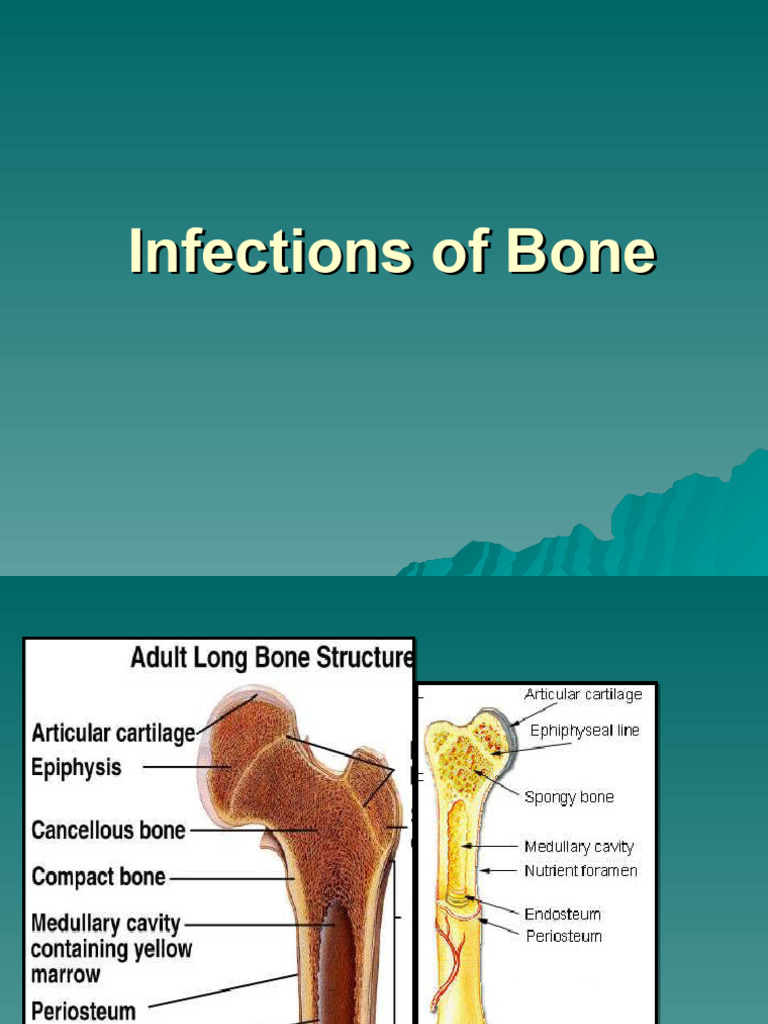 Bone Infections | PDF | Immunology | Diseases And Disorders
