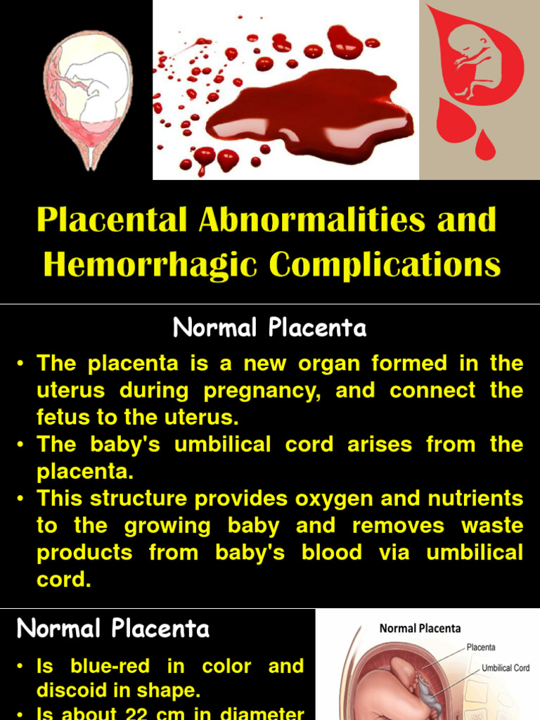 8 Placenta and Hemorrhage | PDF | Miscarriage | Childbirth