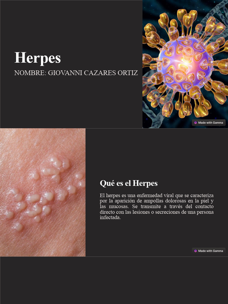Herpes 1 | PDF | Herpes Simple | Enfermedades virales