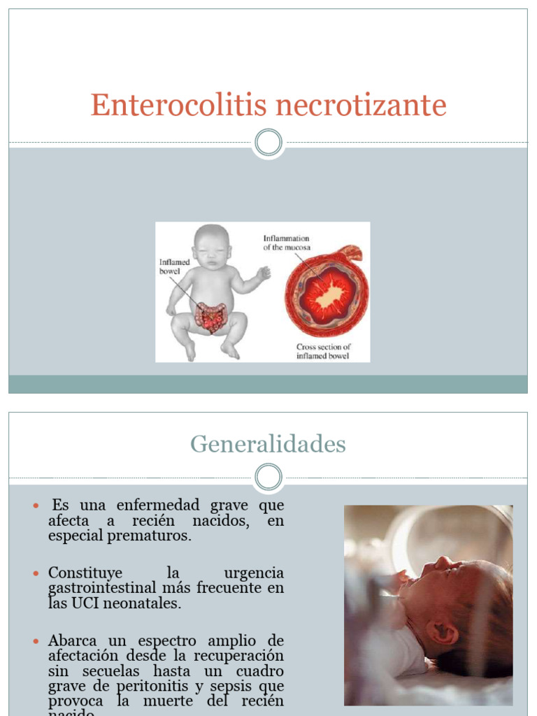 Enterocolitis Necrotizante en Neonatos | PDF | Septicemia ...